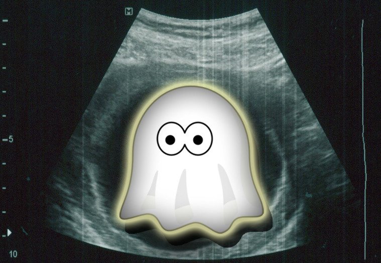 Ghost Abortions: the Hot Anti-Abortion Pseudoscience Trend